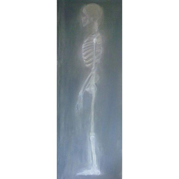 X Ray | Scout & Nimble